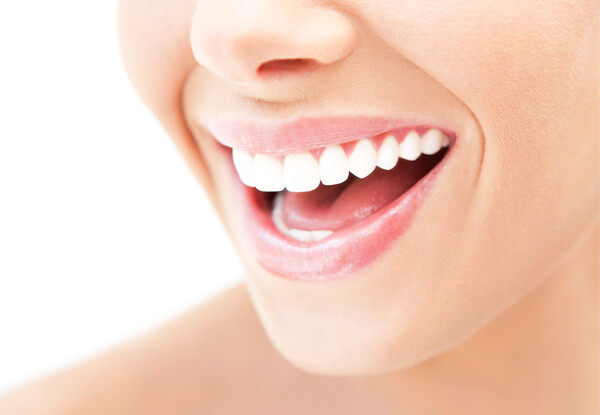 Gentle Dental GrabOne NZ gentle-dental-grabone-nz